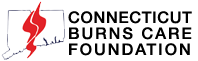 Connecticut Burns Care Foundation – Benefiting the Arthur C. Luf ...